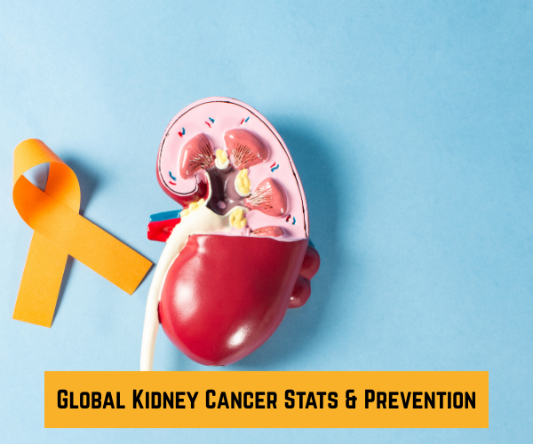 Kidney Cancer Worldwide Data | Latest Global Stats & Risk Factors