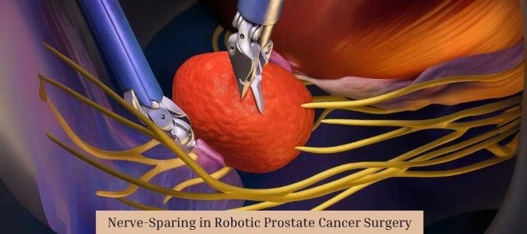 Robotic Prostate Cancer Surgery | Benefits & Recovery