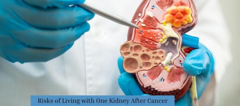 Living with One Kidney After Cancer: Tips for Long-Term Wellness