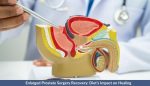 Diet After TURP: Foods That Prevent Constipation & Straining